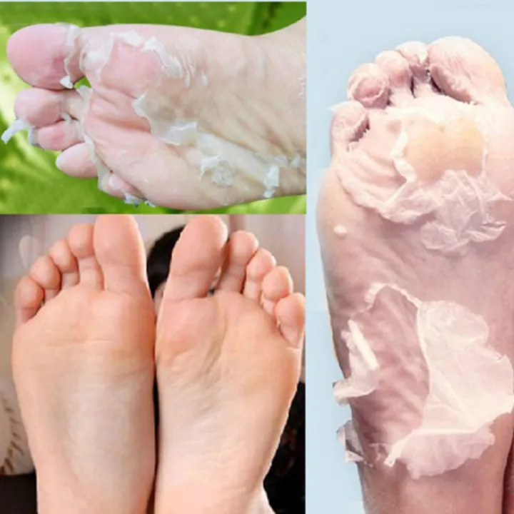 EFERO Honey Foot Mask Exfoliating Foot Mask Dead Skin Pedicure ...