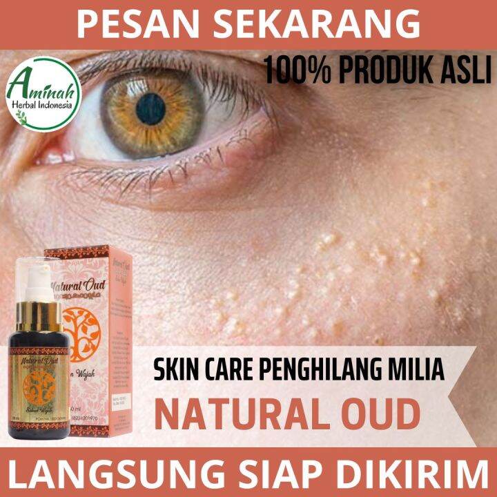 Sabun Menghilangkan Milia NATURAL OUD // Sabun Muka Herbal Penghilang ...