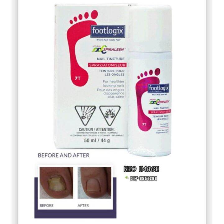 Footlogix Anti Fungal Nail Tincture Spray With Spiraleen 1pc | Lazada