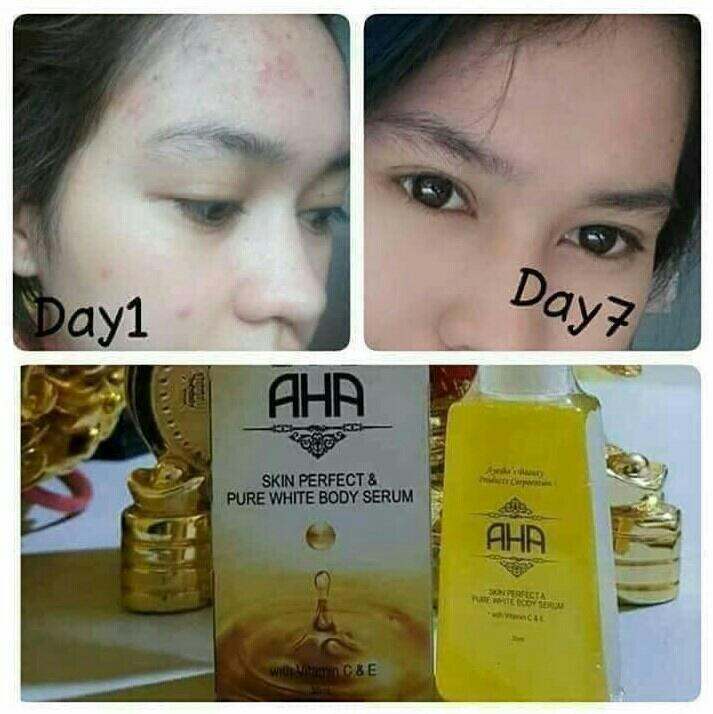 Aha Whitening Serum by Ayesha | Lazada PH