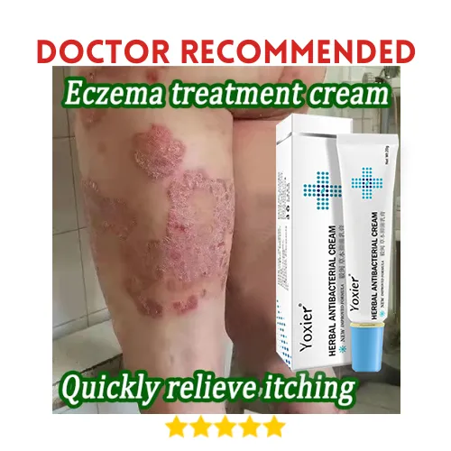 Yoxier Herbal Antibacterial Cream Psoriasis Ointment Eczema Eczema