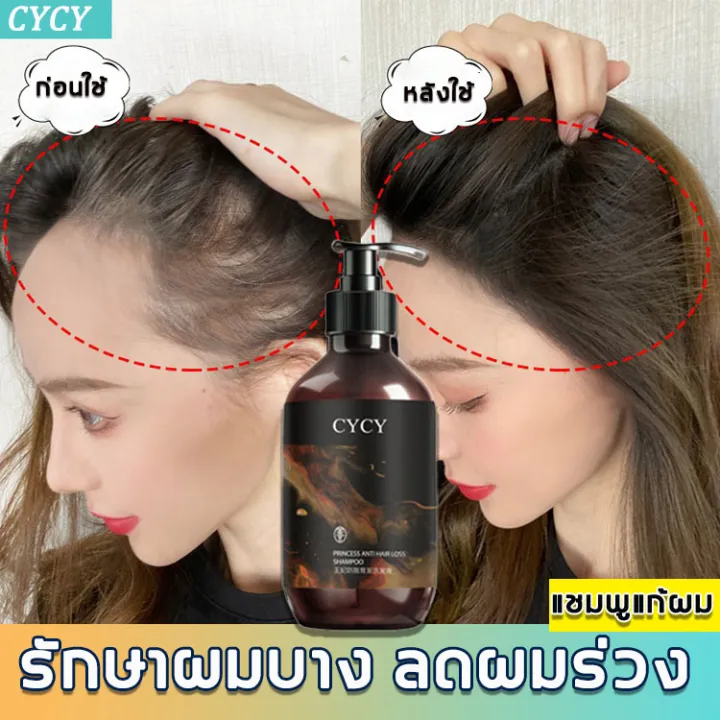 CyCy แชมพูแก้ผมร่วง 400MLรักษาผมบาง ลดผมร่วง เสริมสร้างเส้นผม เร่งการปลูกของเส้นผม（แชมพู ยาสระผม ...