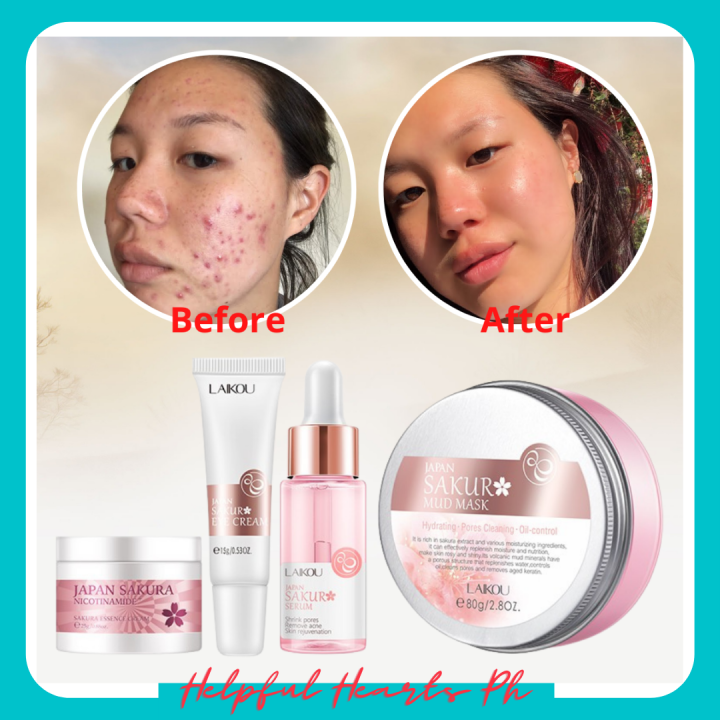 AUTHENTIC Japan Sakura Skin Care Set for All types Of skin Sensitive ...