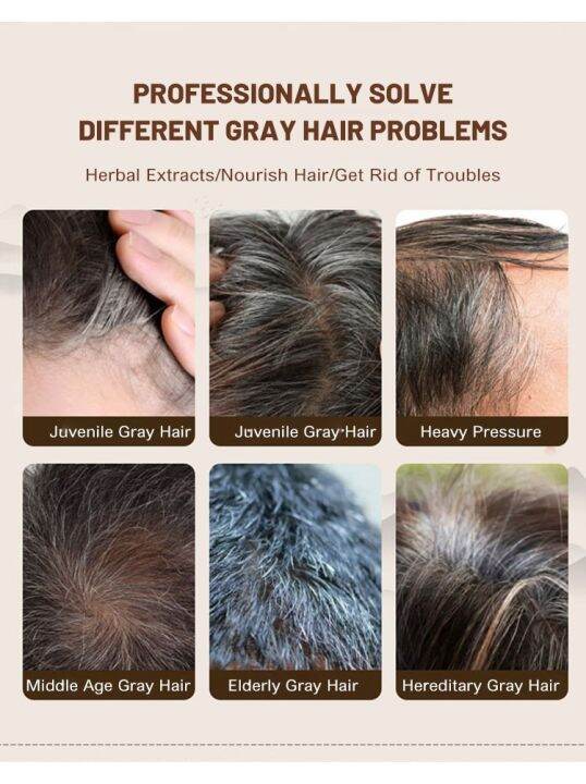 ganze011 Herbal Gray Hair Reverse Essence/Restore Black Hair Serum ...