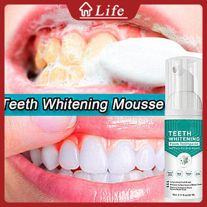 Teeth Whitening Toothpaste for Oral Health Breath Hygiene Tartar ...