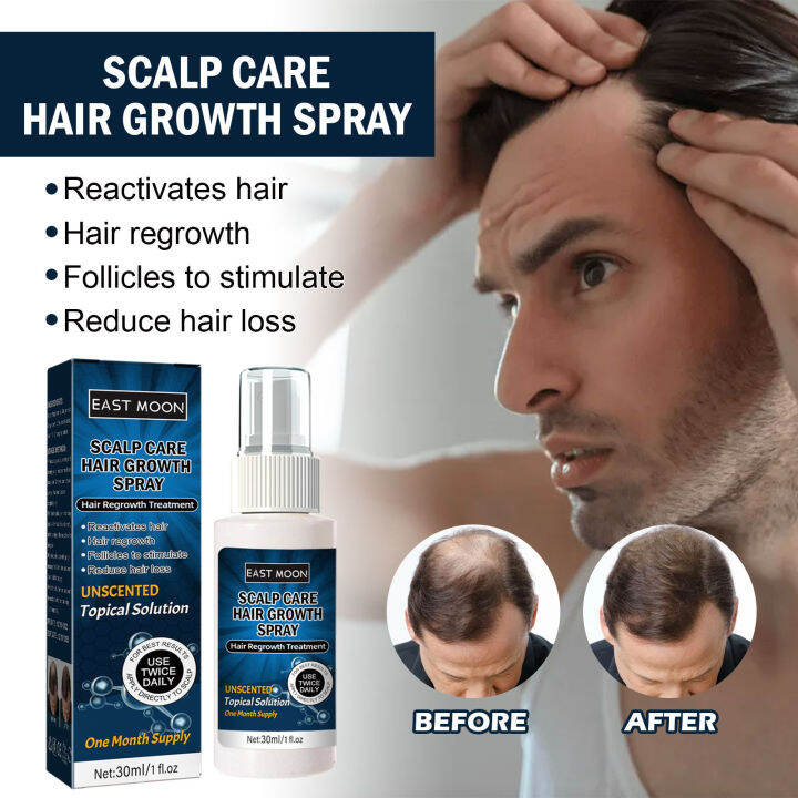 Men's hair growth spray hairline anti drop thick growth hair firming ...