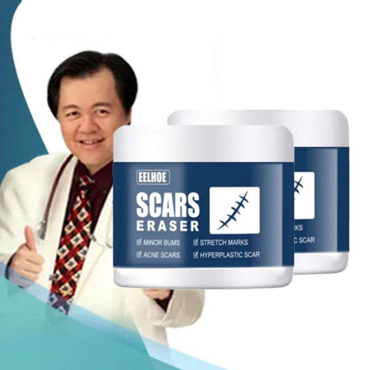scar remover for old scar on leg fix scar removal original scars ...