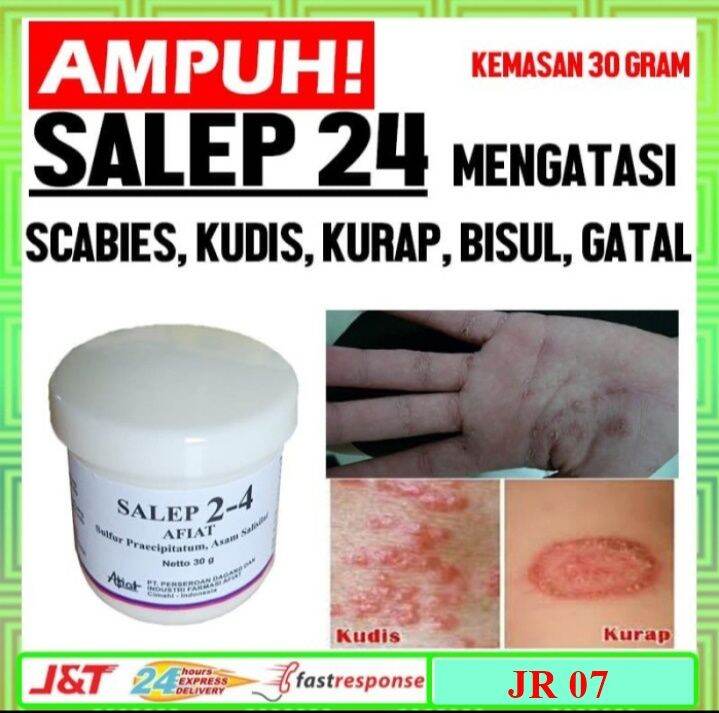 Salep 2-4 Afiat 30 gr / Salep Obat Kulit untuk Kudis, jamur ...