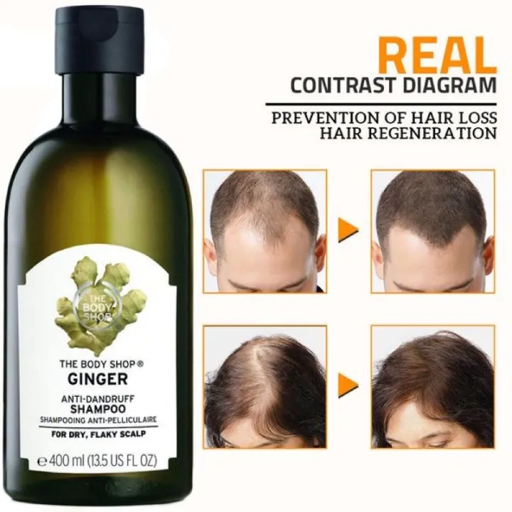 The Body Shop Ginger Shampoo Hair Care Anti Dandruff Hair Loss Control ...