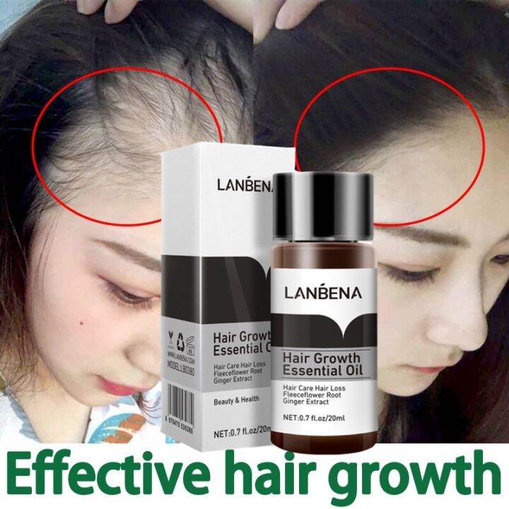Lanbena Hair Growth Essence Oli Essential Oil Liquid Preventing Hair