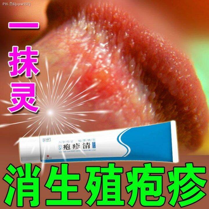 M Long Term Venereal Genital Herpes Anti Recurrence Simple Hsv Sequela Erythema Ulcer Blister