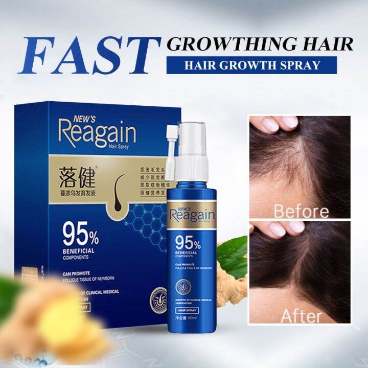 【authentic Authorization】fast Hair Growth Essence Spray Essential Oil