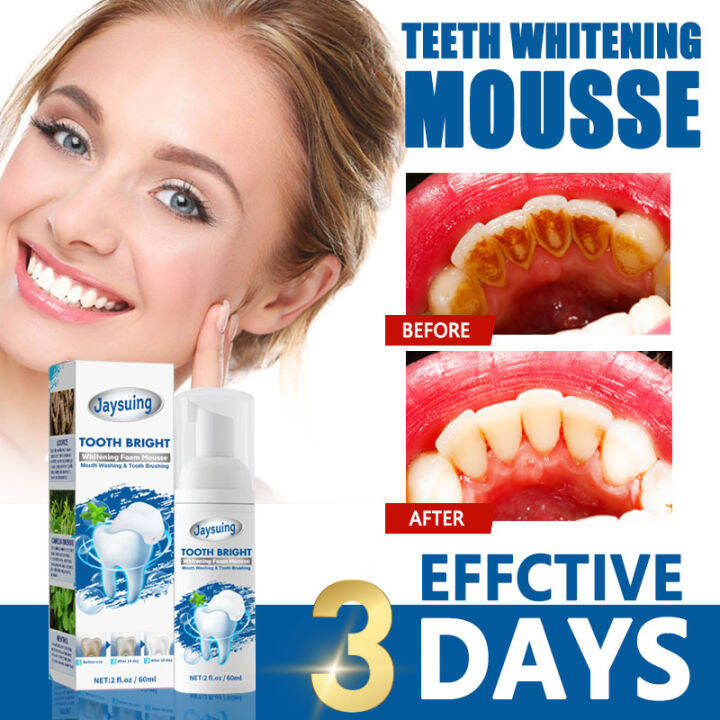 teeth whitening and tartar remover for teeth hunmui teeth whitening ...