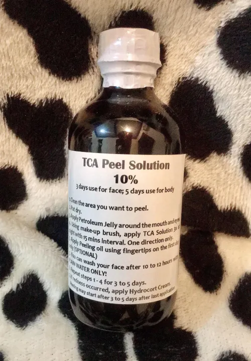 TCA Peel Solution 15% 120ml | Lazada PH