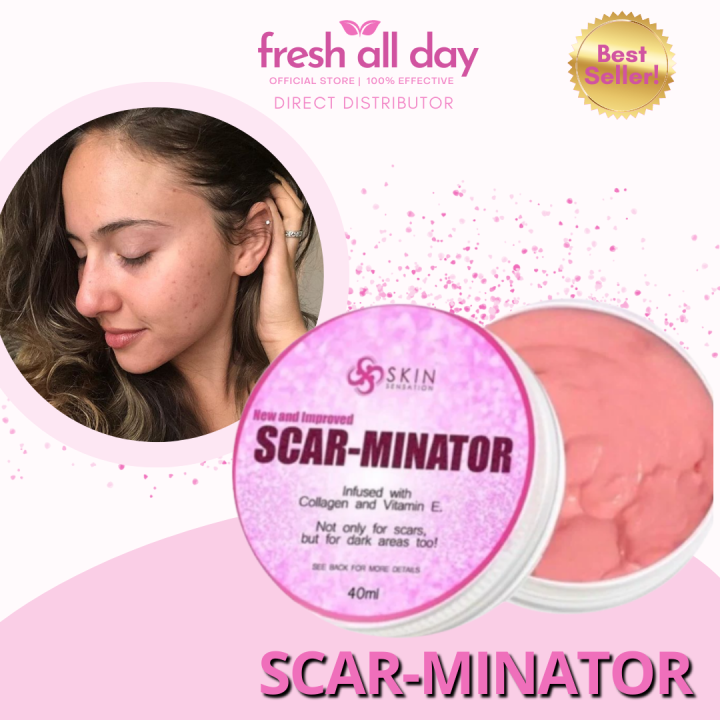 Original And Effective Scarminator Cream By Skin Sensation 40g Best