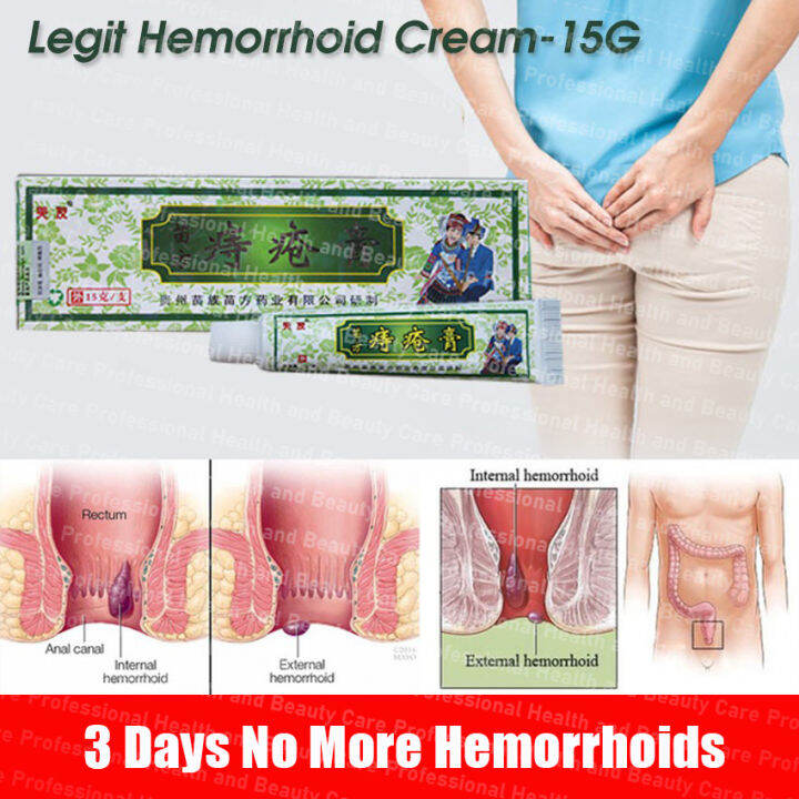 Original Hemorrhoids Cream Miracle Ointment Anti Almoranas, Anti ...