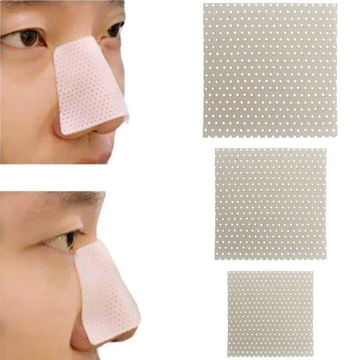 Low Temperature Thermoplastic Nose Splint Job Rhinoplasty Ortho ...