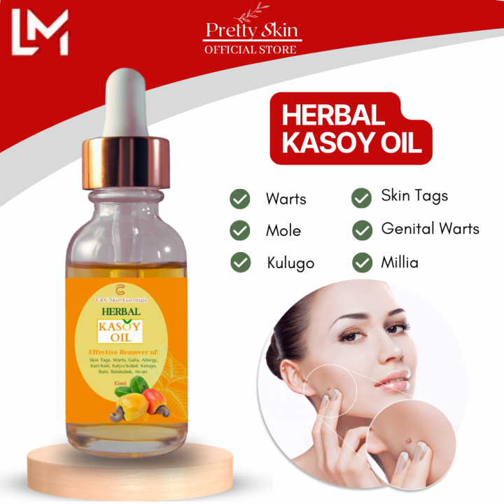 Pure Kasoy Oil: The Original and Organic Formula for Safe and Effective ...