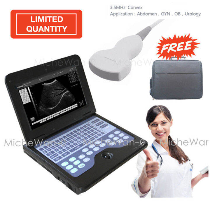CONTEC Ultrasound Scanner Portable Laptop Digital Machine 3.5mhz Convex ...