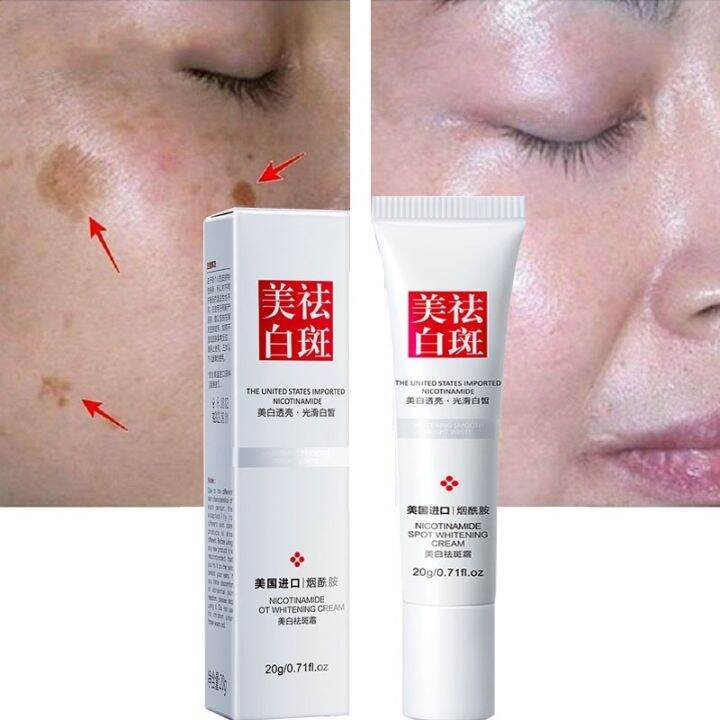 Korea Original 20g Niacinamide freckles remover facial cream melasma ...