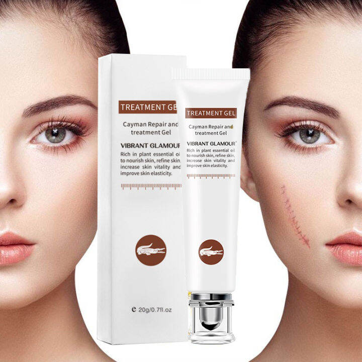 Traditional Chinese Medicine Scar Removing Cream Natural Repair Skin ...