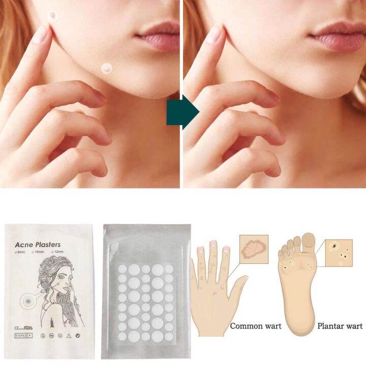 CAG Shop Clear 36sheet Acne Treatment Pimple Patches Sticker | Lazada PH