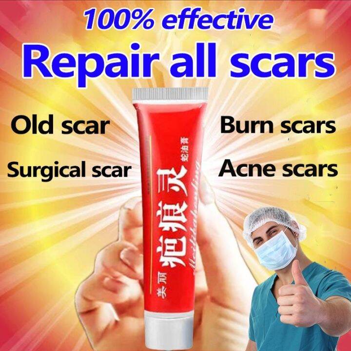 ZWER 100 Original Scar Repair Cream Scars Remover For Old Scars Scar ...