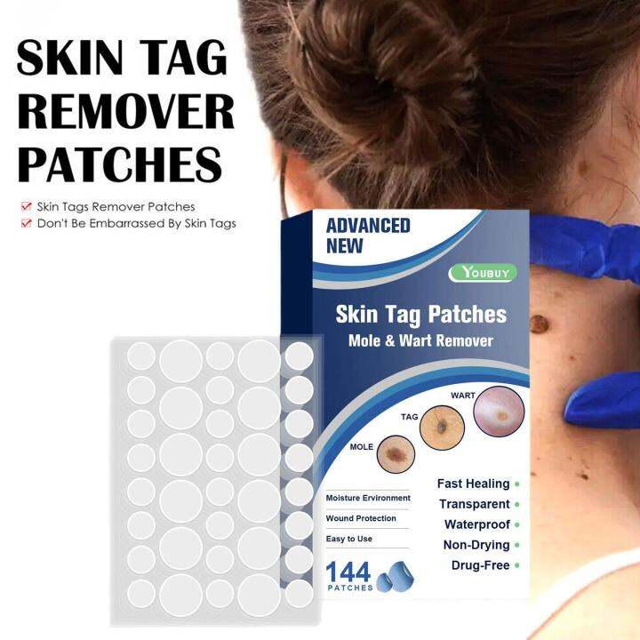 HOLD LIVE Warts Remover Patch Skin Tags Remover Invisible Remover ...