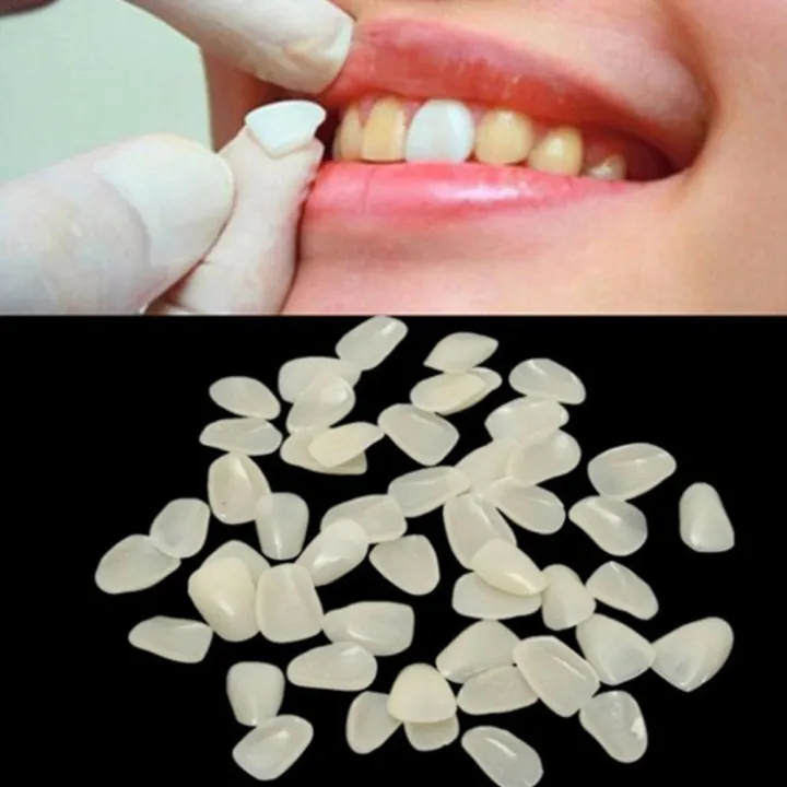 Dental Ultra thin Whitening Veneers Resin False Teeth Temporary ...
