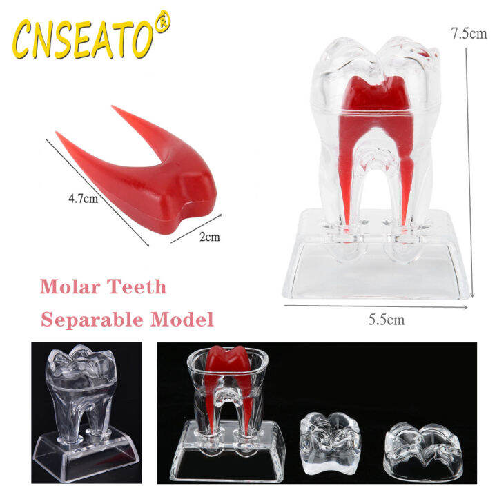 Dental Molar Teeth Model Separable Plastic Tooth Endodontic Student ...