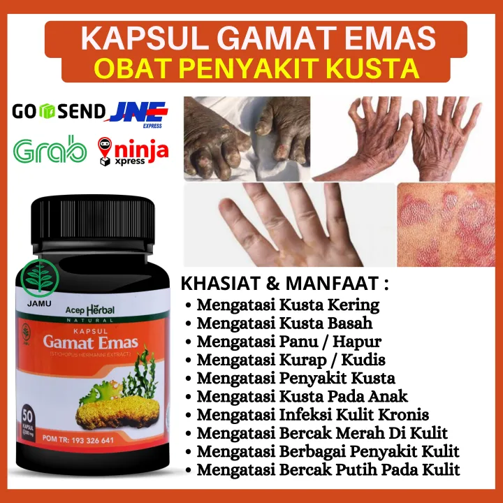 KAPSUL GAMAT EMAS ASLI - Obat Untuk Penyakit Kusta Alami Kusta Kering ...
