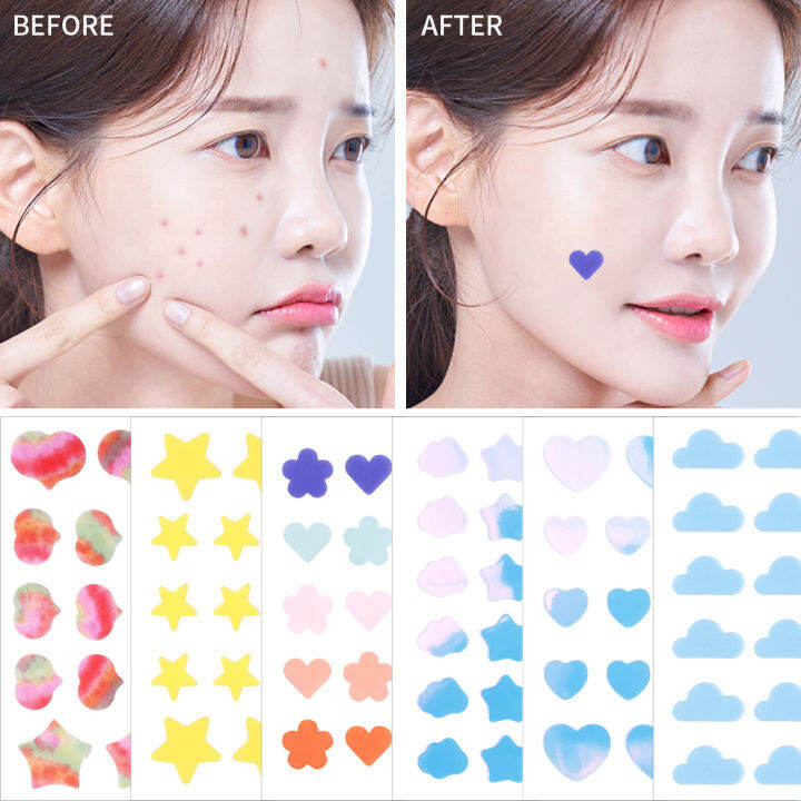 Colorful Pimple Patch Invisible Acne Skin Care Stickers Concealer ...