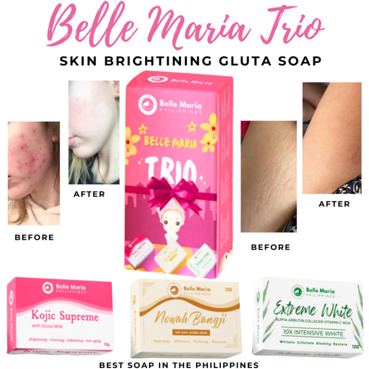 Belle Maria Trio Soap For Pimple/Peklat/Acne Scar Remover Like Tokyo ...