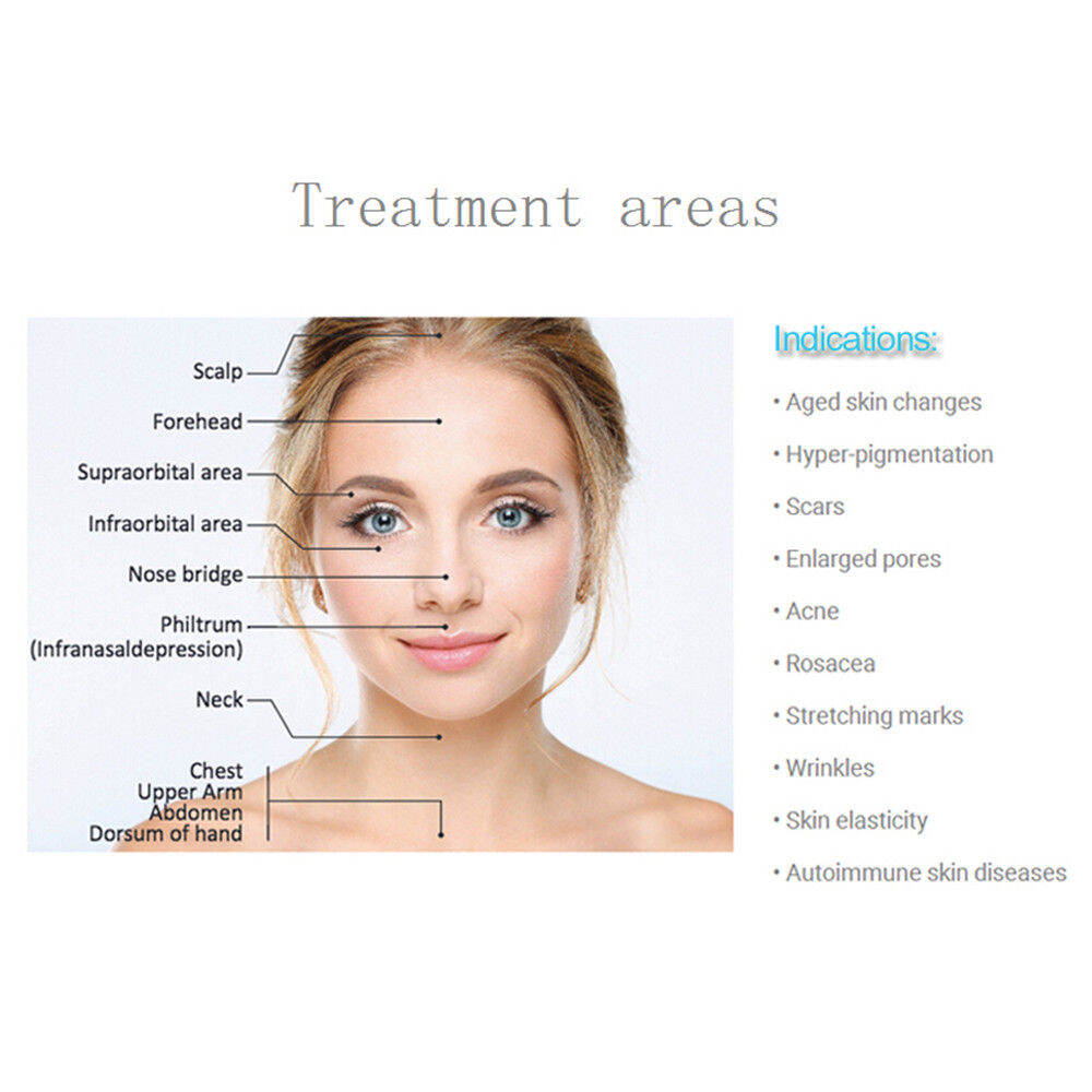 5210A 540 รักษาผมร่วง สุขภาพดี ต่อต้านริ้วรอย หนวดเครา ลูกกลิ้งผิวหนัง Derma เทอราพี สกินแคร์ ...