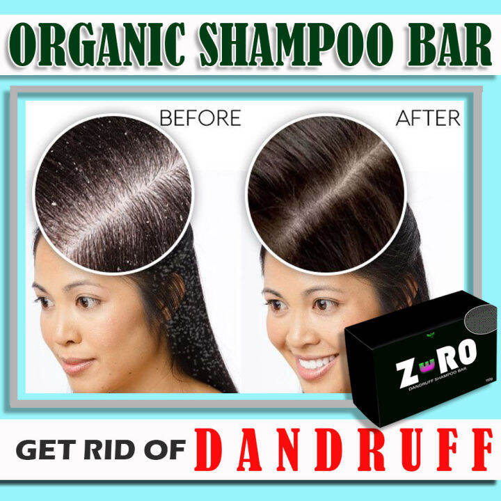 ZERO Dandruff Shampoo Bar dandruff remover , hair treatment for itchy ...