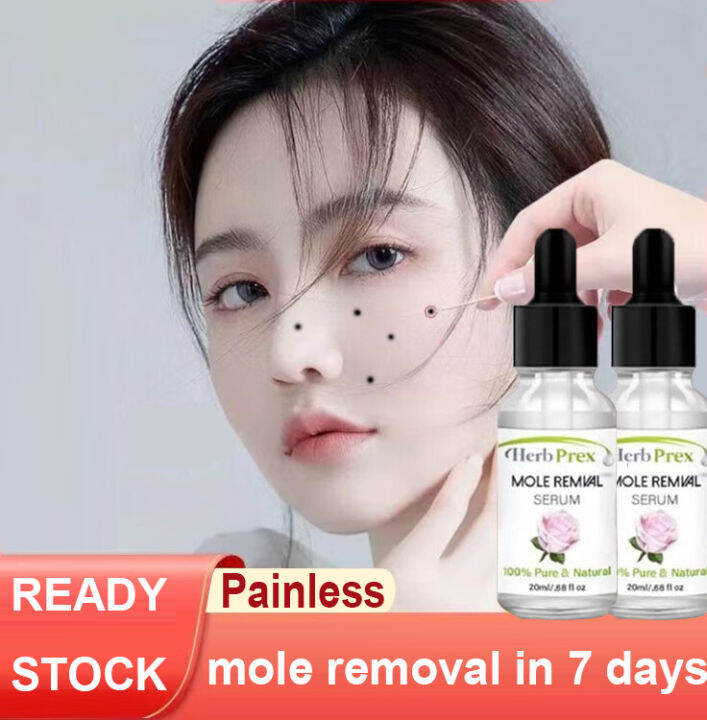 Liquid Wart Mole Removal Serum Skin Tag Removal liquid Painless Mole ...