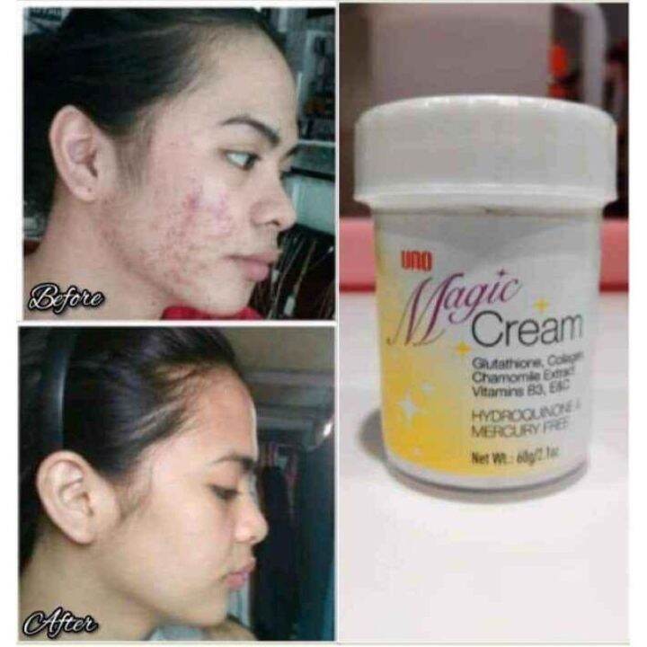 Lovely Beauty PH Buy Uno Magic Cream Original not Sy Glow Seven Days ...