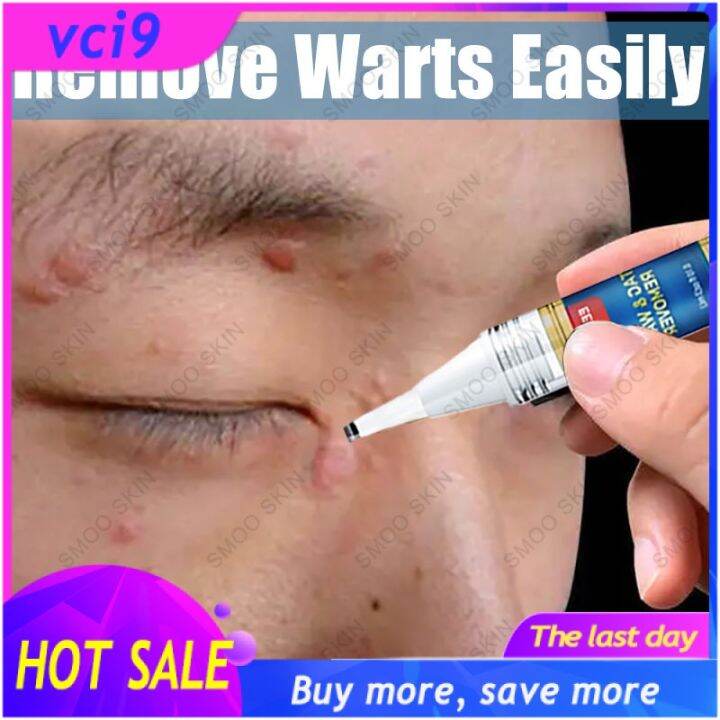 Hot 】Buy 2 Take 1COD Warts Remover Original Kasoy Oil Warts Remover Mole Remover Organic Cream ...