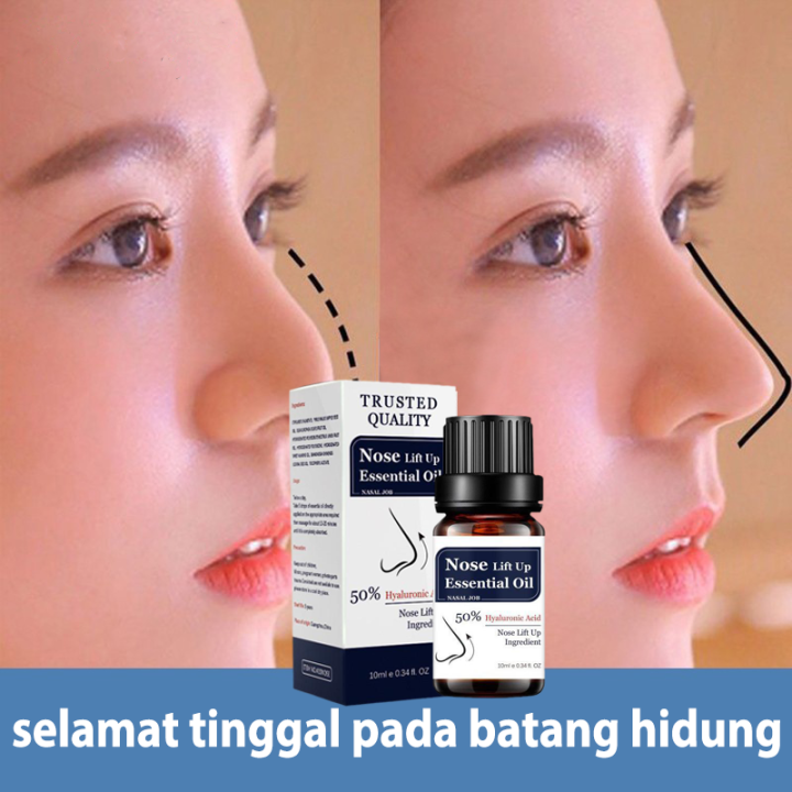 Minyak remodeling tulang hidung efisiensi tinggi dan kuat krim esensce ...