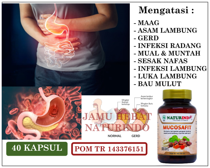 Mucosafit Obat Asam Lambung, Maag, Tukak Lambung, Nyeri Lambung, Luka ...