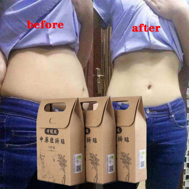 Only-1（10PCS) Original Detox And Slimming Patches Navel Stick Weight ...