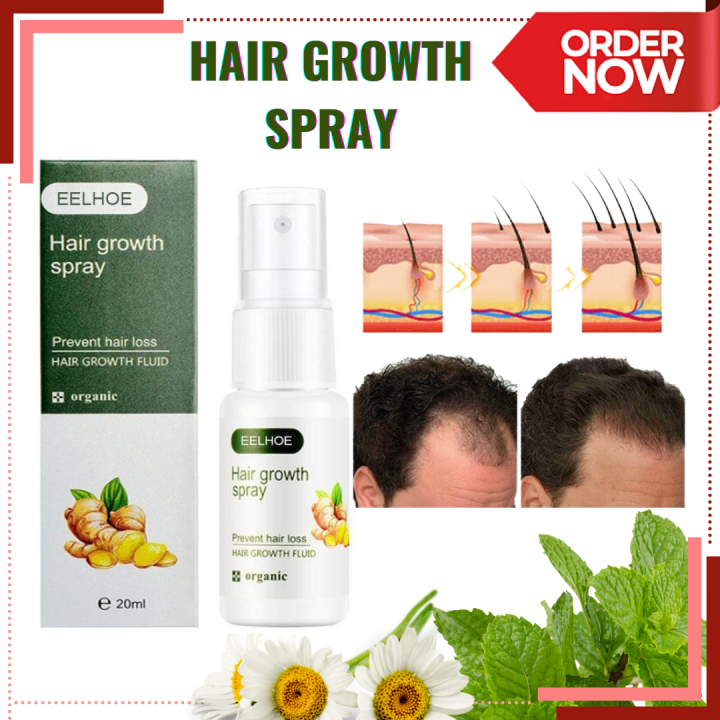 NEW ARRIVAL Regrowth Ginger Spray Fast Hair Growth Fluid Anti Loss ...