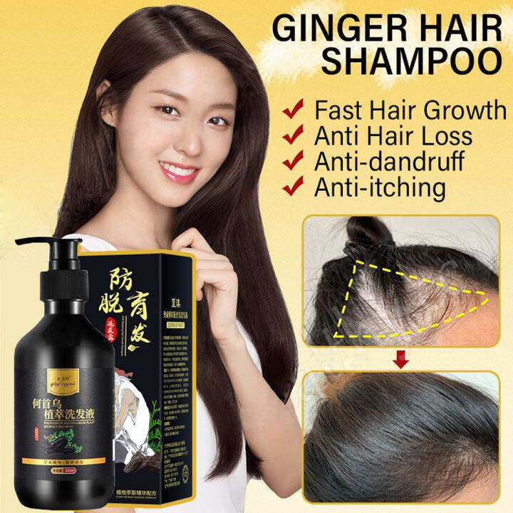 【Buy 1 get 1 free】Polygonum multiflorum shampoo 300ML is used for turning white hair into black ...