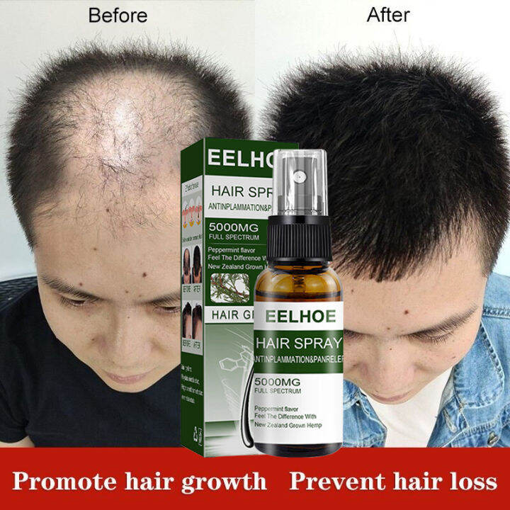 ⚡thicker Hair In 7 Days⚡eelhoe Hair Growth Spray 50mlfast Powerful Hair