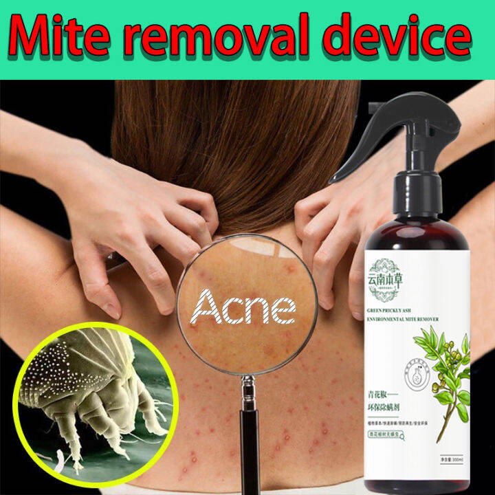 Mite Spray Insect Spray Bed Bug Killer Mite Killer Health Non-toxic ...