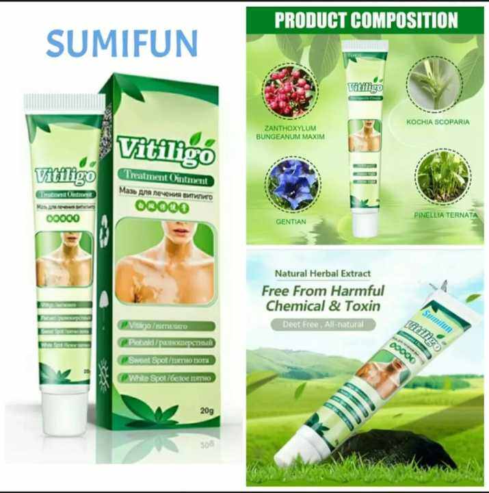 Salep Cream Vitiligo - Untuk kulit bercak putih 20 Gram | Lazada Indonesia