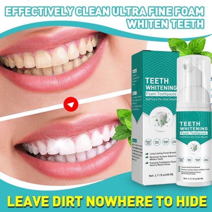 ALIVER TEETH Whitening Mousse Toothpaste Cleansing Teeth Mousse Remove ...