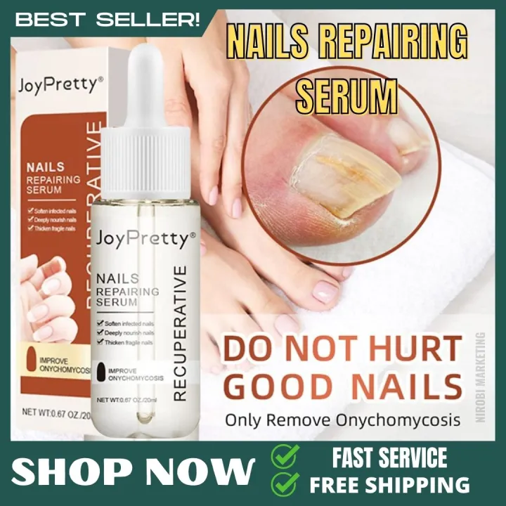 HOT DEALS Nail Repair Serum Anti Infection Foot Repair Essence Care ...