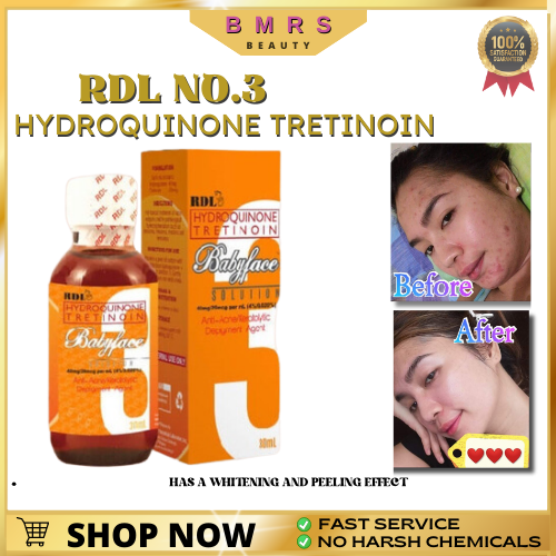 RDL Hydroquinone Tretinoin Babyface Solution 3 | Lazada PH