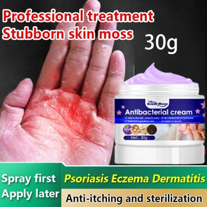 Salep Khusus Psoriasis - Import - Kurap Pada Kulit Kepala - Kutu Air ...